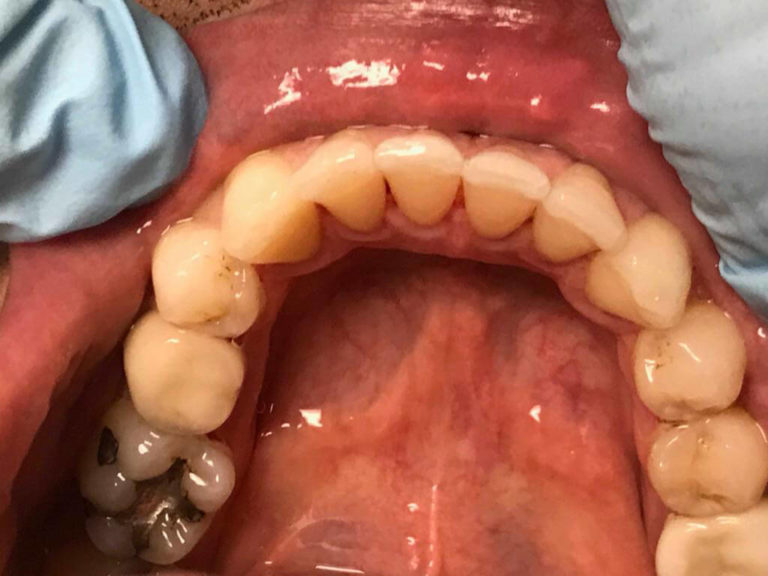 Gallery - Family & Cosmetic Dentist in Columbia, MD | Elegant Dental Care